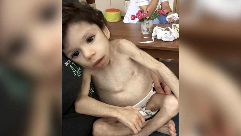 Couple saw a photo of a neglected 7-year-old boy and decided to adopt ...